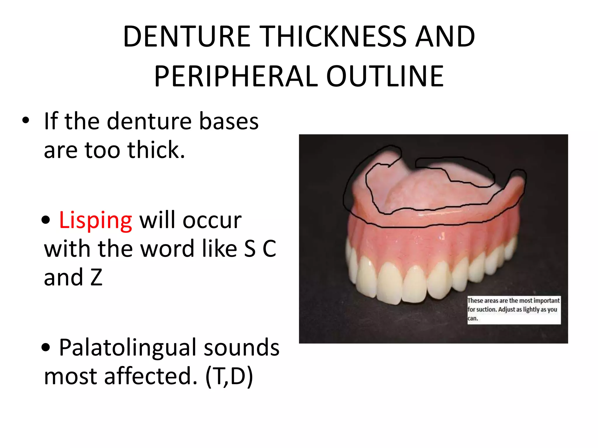 Phonetic in complete denture | PPTX