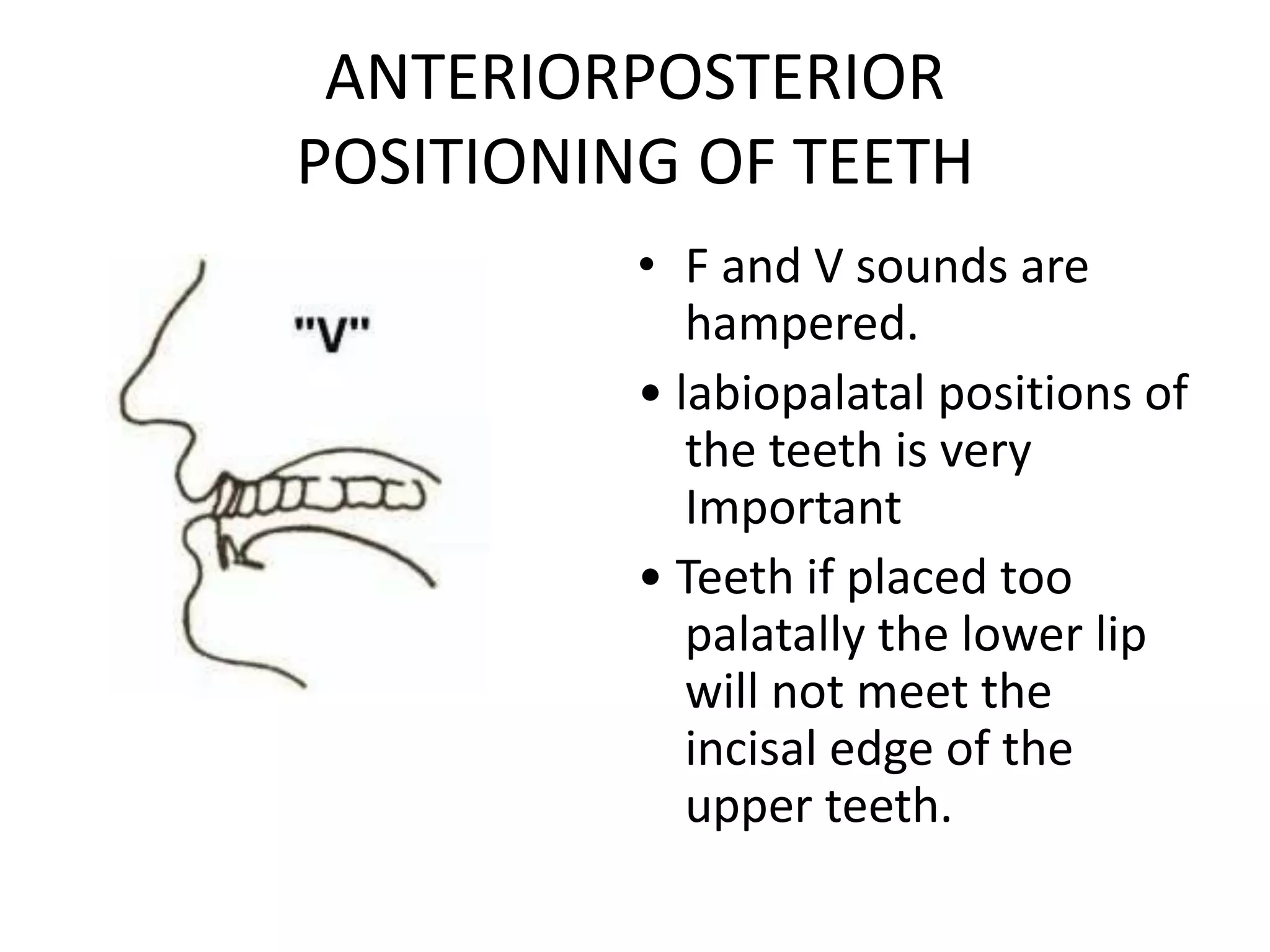 Phonetic in complete denture | PPTX