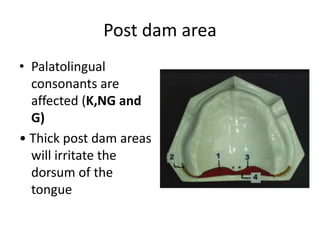 Phonetic in complete denture | PPTX