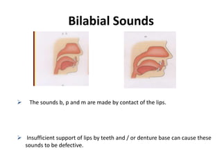 PHONETICS IN COMPLETE DENTURE.ppt