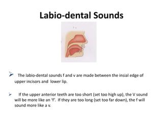 PHONETICS IN COMPLETE DENTURE.ppt
