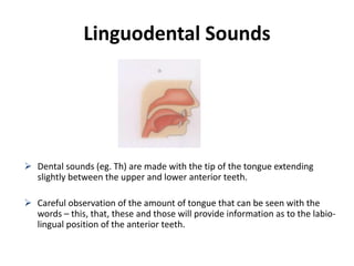 PHONETICS IN COMPLETE DENTURE.ppt