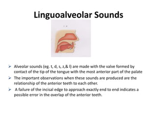 PHONETICS IN COMPLETE DENTURE.ppt