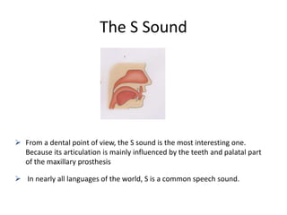 PHONETICS IN COMPLETE DENTURE.ppt