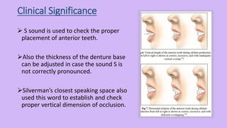 Phonetics in Complete Denture.pptx