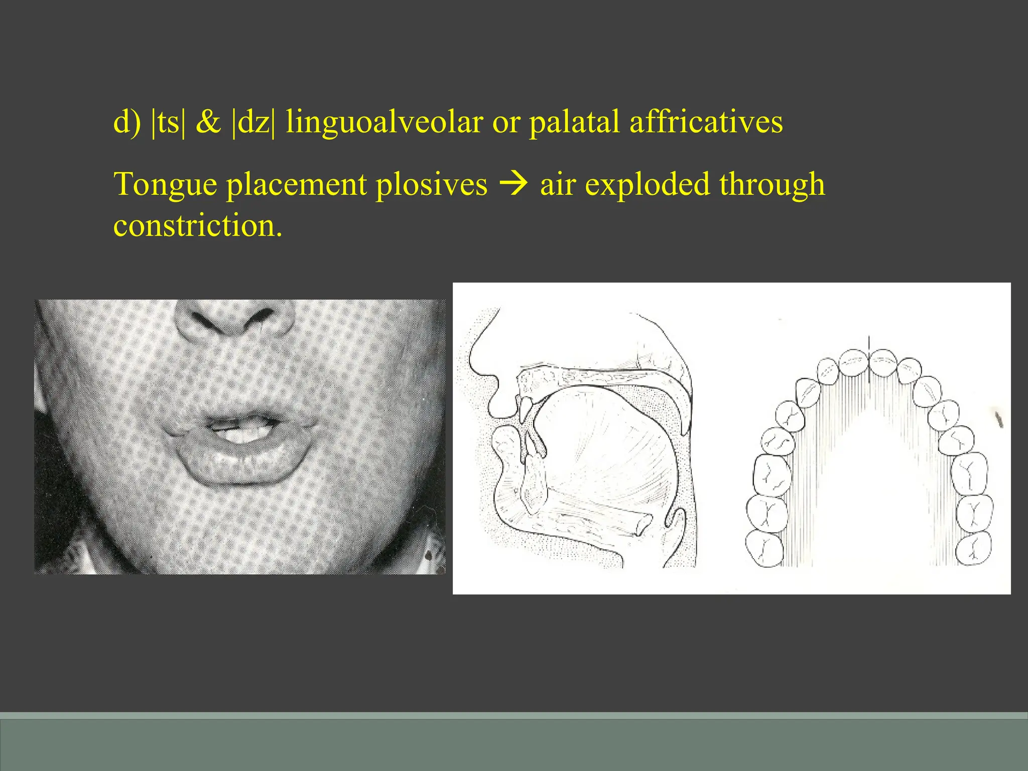 PHONETICS IN COMPLETE DENTURES final.ppt