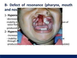 Phoniatrics musa | PPT