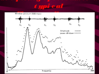Phonocardiogram | PPT