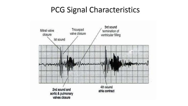 Phonocardiogram | PDF