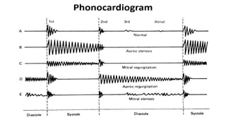 Phonocardiogram | PDF