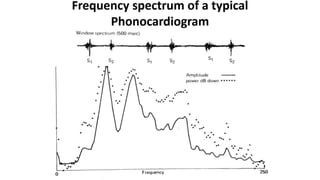 Phonocardiogram | PDF