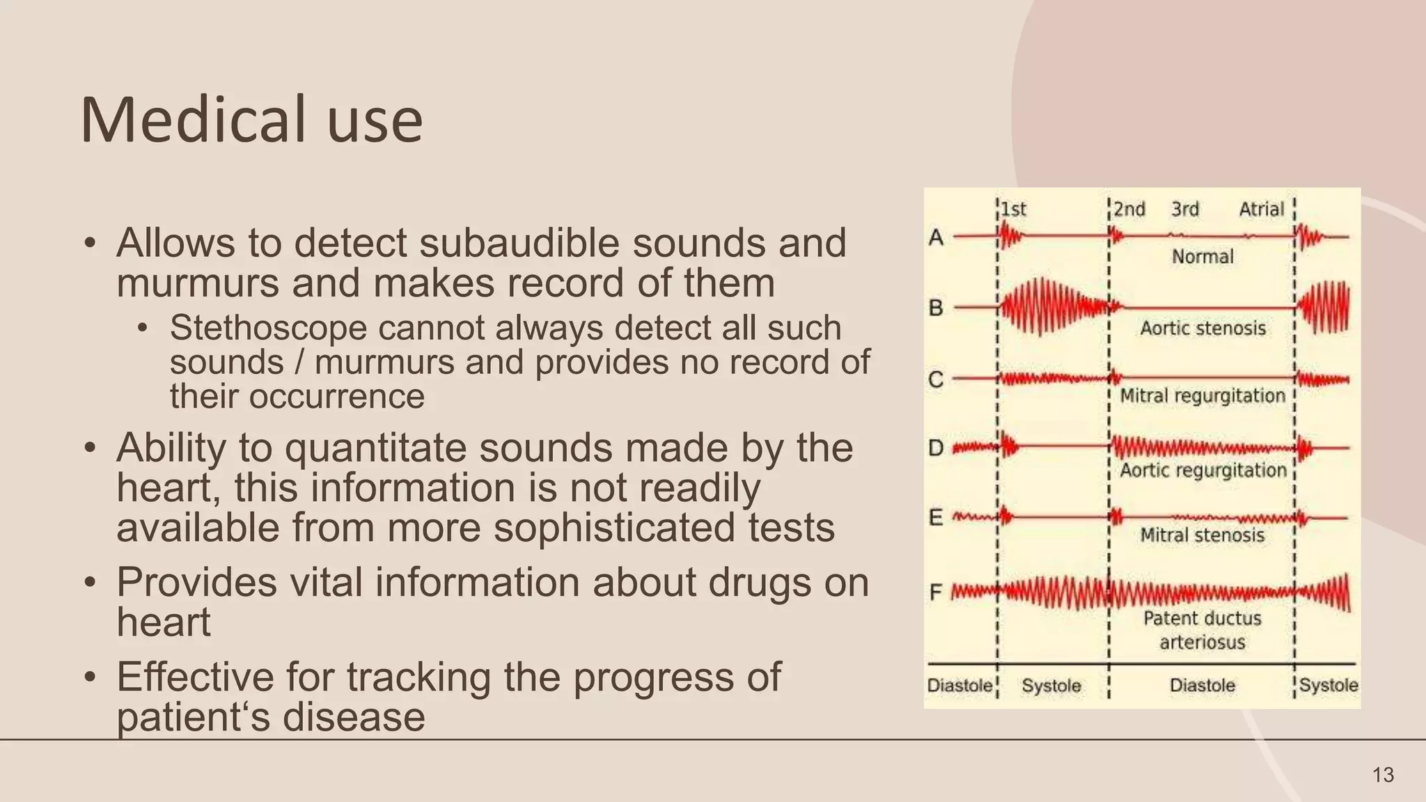 Phonocardiogram.pptx