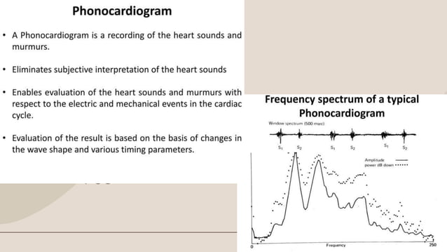 Phonocardiogram.pptx | Heart and Cardiovascular Diseases | Diseases and ...