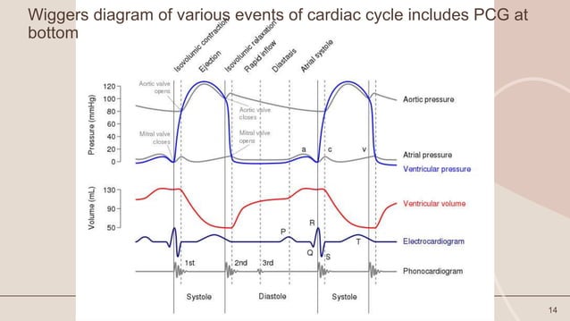 Phonocardiogram.pptx | Heart and Cardiovascular Diseases | Diseases and ...