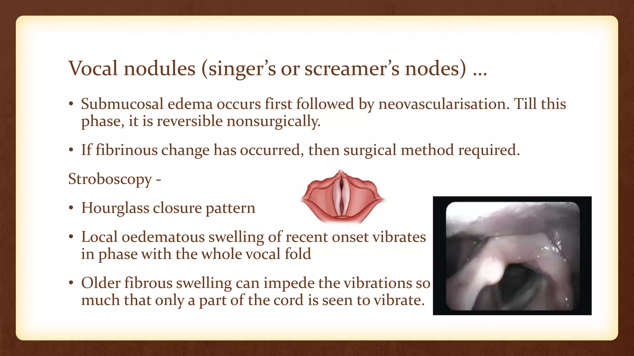 Phonosurgery | PDF