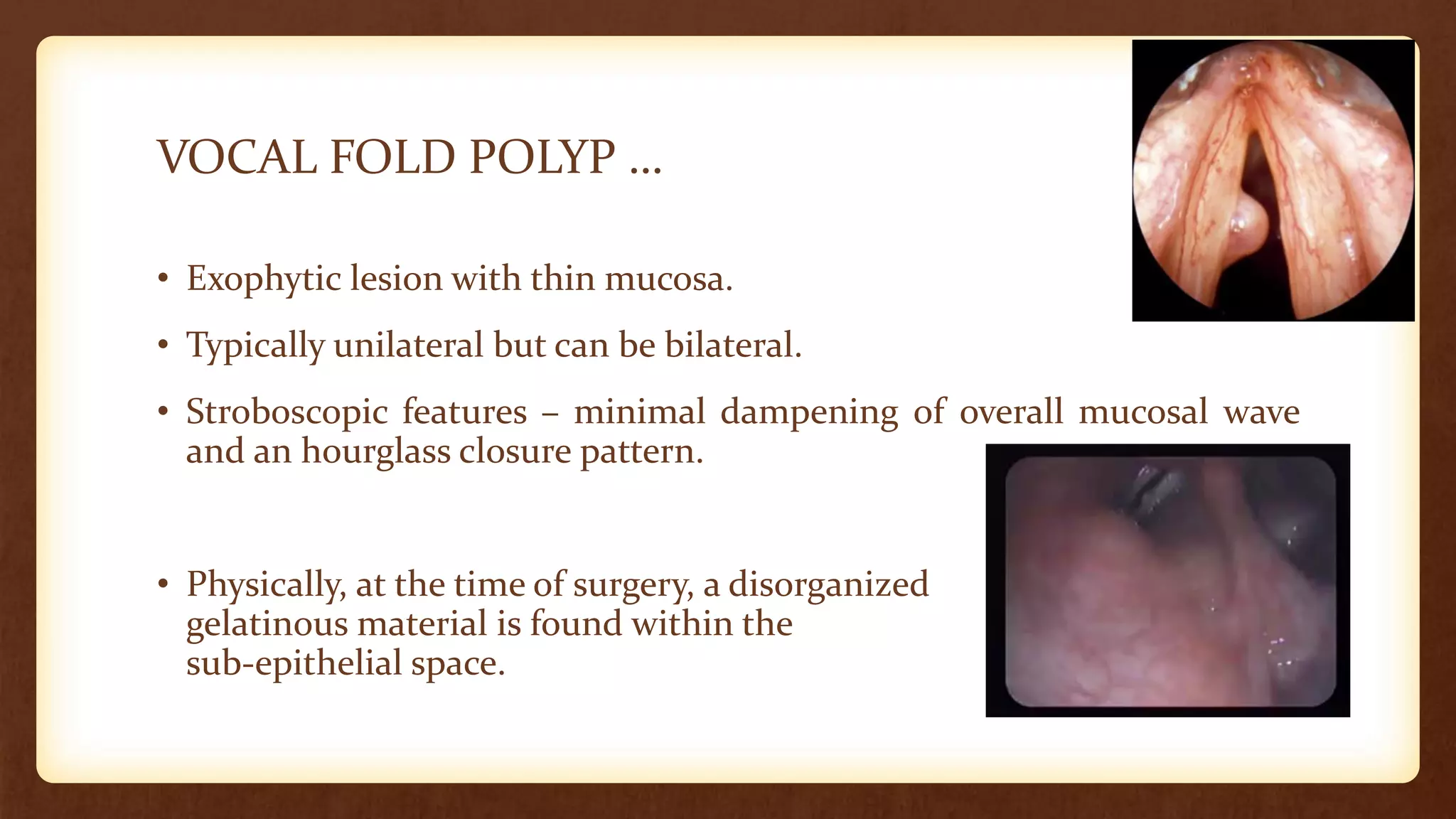 Phonosurgery | PDF