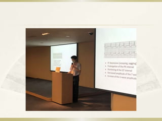 Challenging and Unknown ECGs (2) | PPT | Heart and Cardiovascular ...