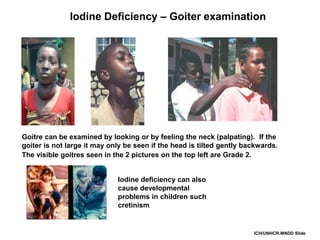 Photocards.ppt | Thyroid Disorders | Endocrine and Metabolic Diseases