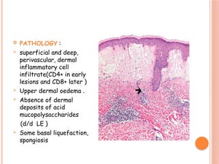 Photobiology and photosensitive dermatoses | PPTX