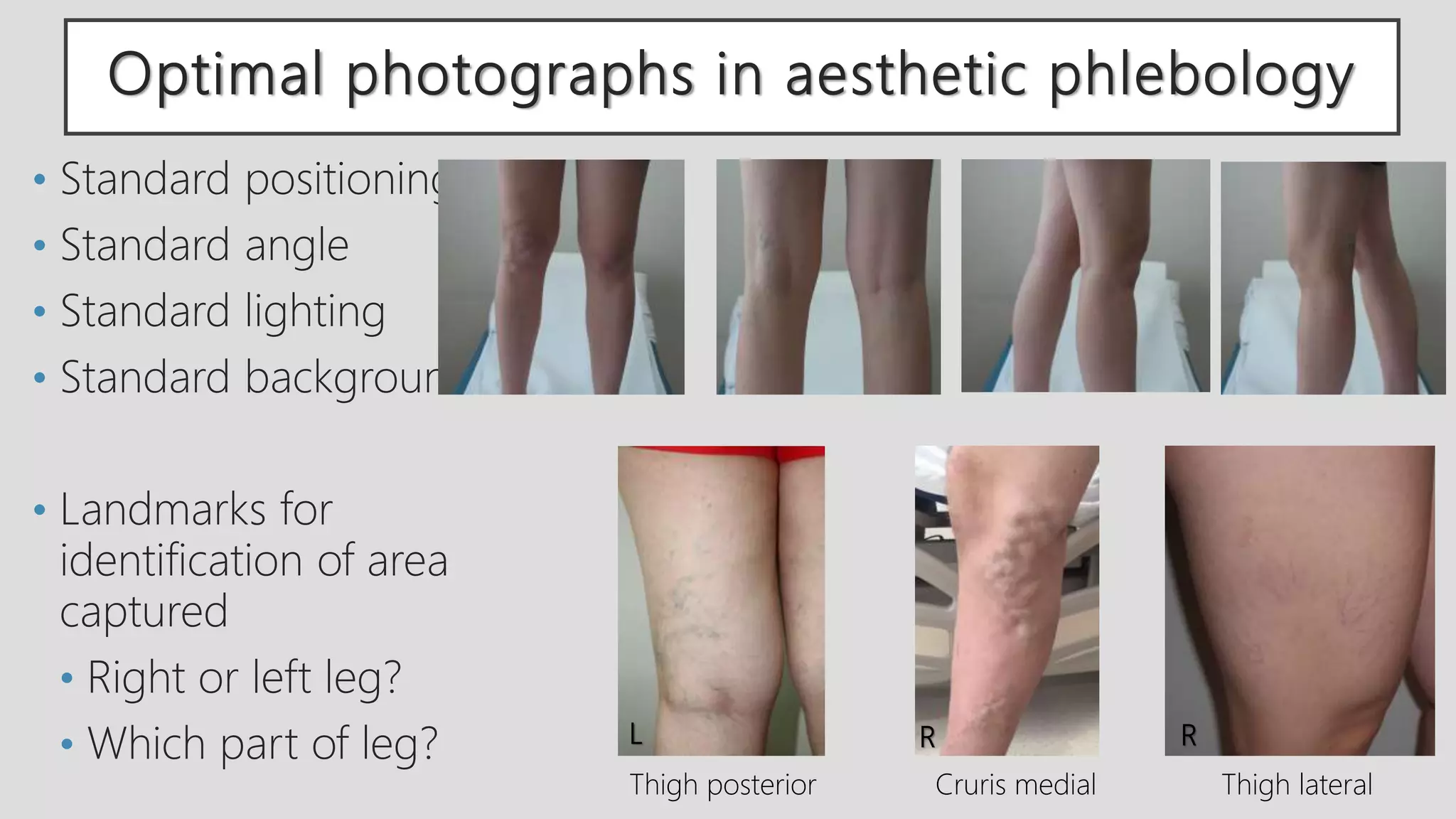Photo documentation in aesthetic phlebology | PPTX