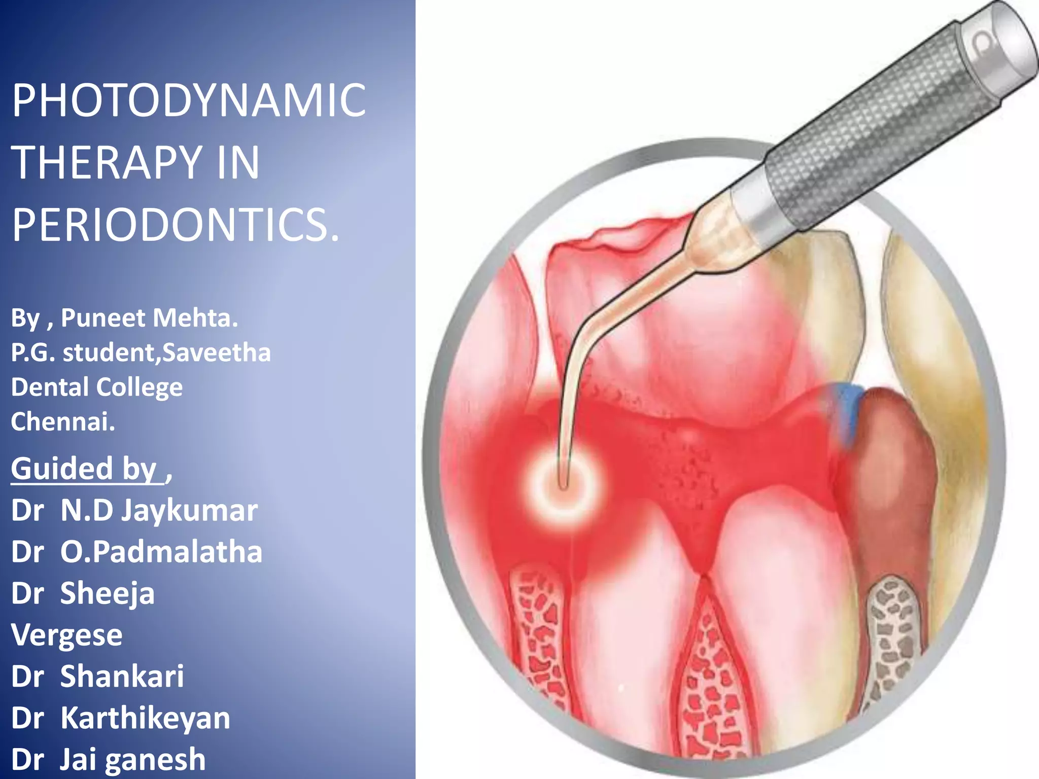 PHOTODYNAMIC THERAPY IN PERIODONTICS.pptx