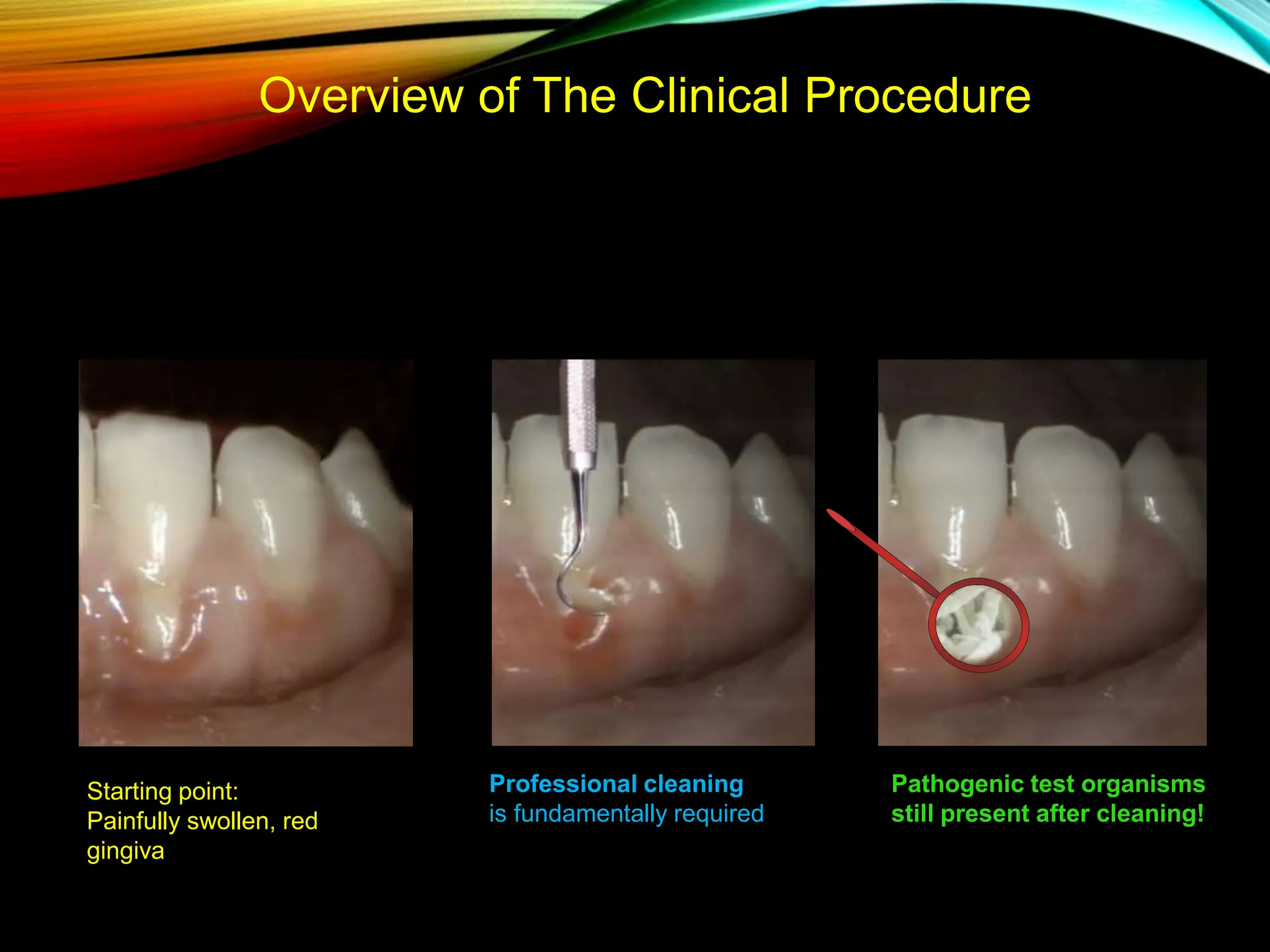 photodynamic therapy in periodontology.pptx