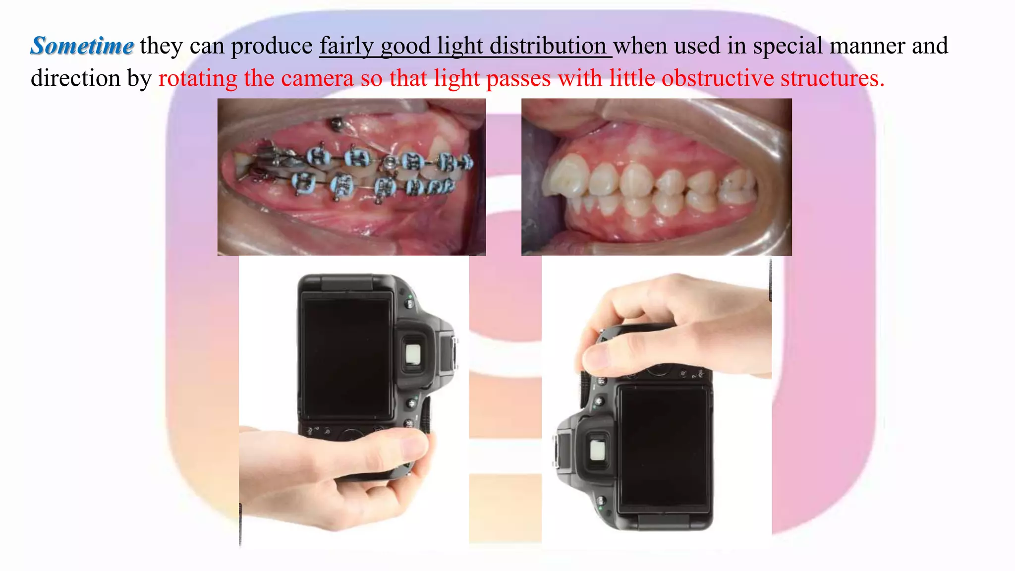 Photography in Orthodontics | PPTX