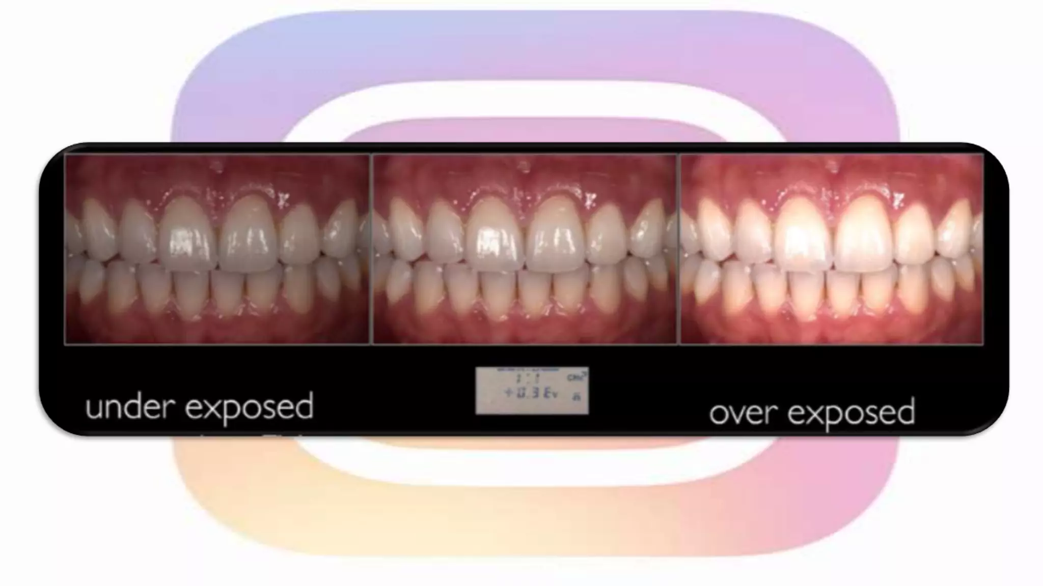 Photography in Orthodontics | PPTX