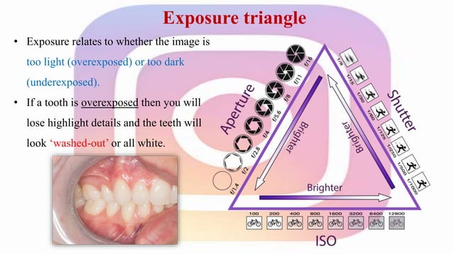 Photography in Orthodontics | PPTX