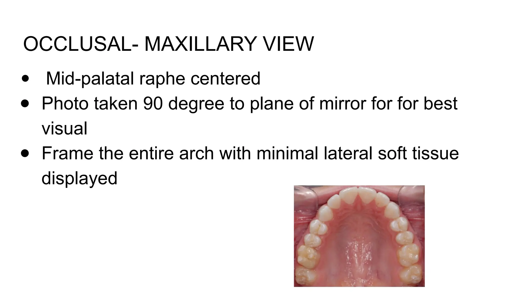 PHOTOGRAPHY IN ORTHODONTICS.pptx required in dental profession | PPTX