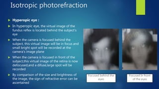 Photorefraction | PPTX