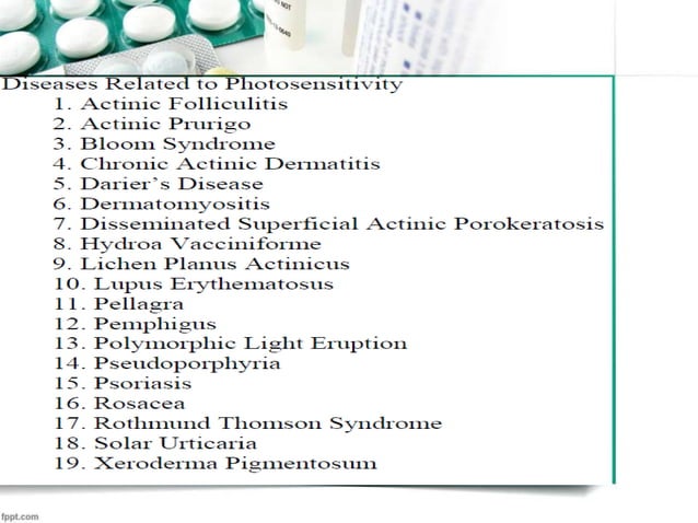 Photosensitivity | PPTX