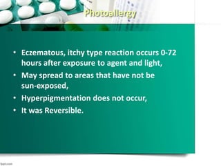 Photosensitivity | PPTX