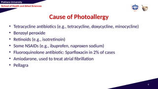 A presentation on Photosensitivity.pptx