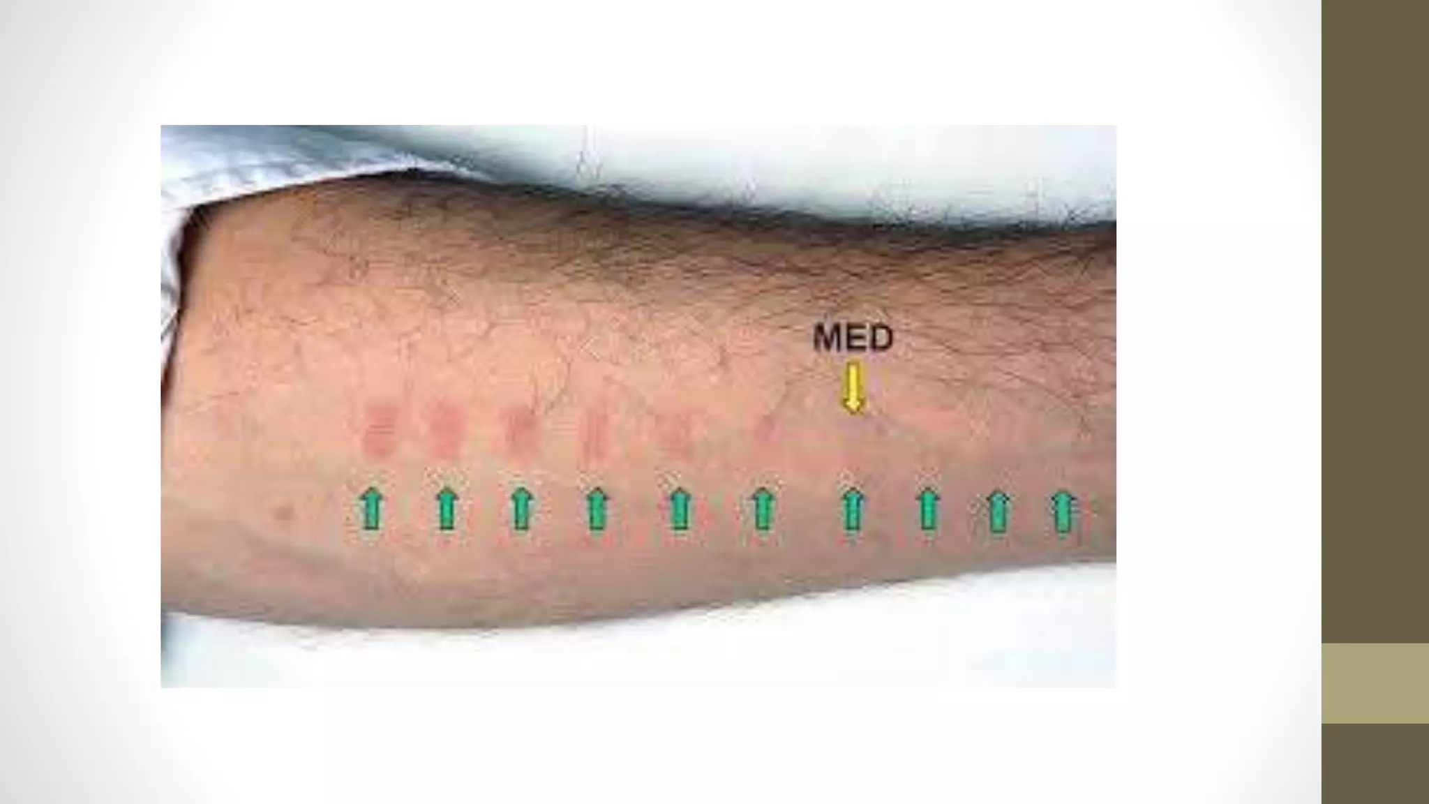 Phototherapy in Dermatology. | PPTX