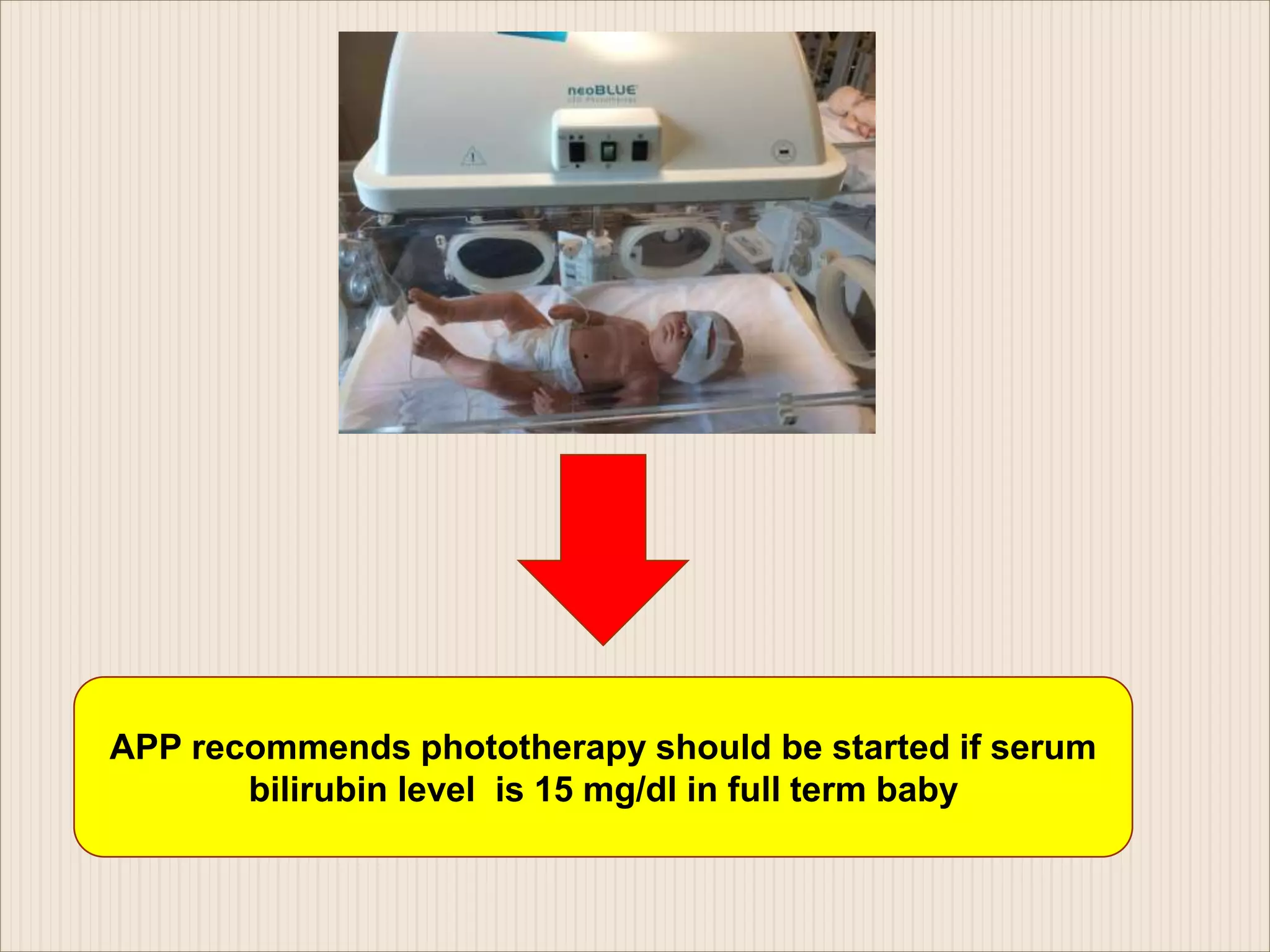 Phototherapy in neonatal jaundice | PPTX