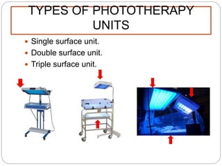 Phototherapy in neonatal jaundice | PPTX