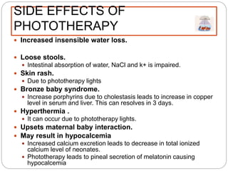 Phototherapy in neonatal jaundice | PPTX
