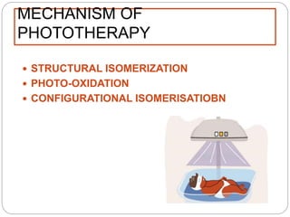 Phototherapy For Jaundice Mechanism