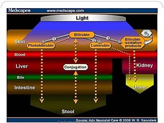 Phototherapy For Jaundice Mechanism