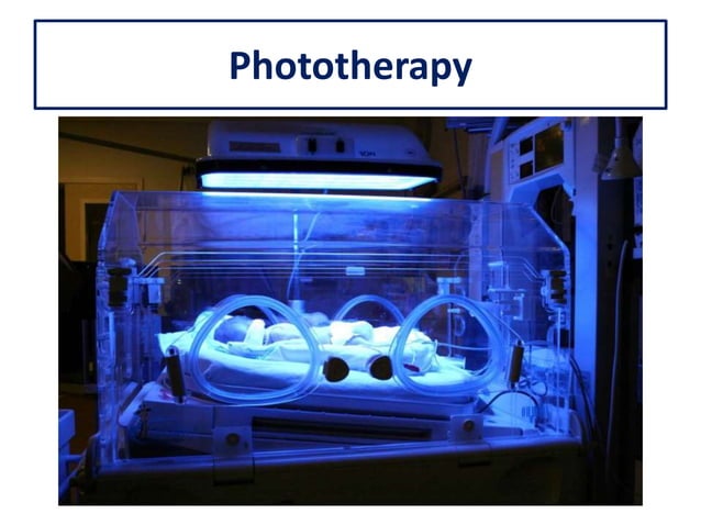Phototherapy in jaundice | PPTX | Blood Disorders | Diseases and Conditions
