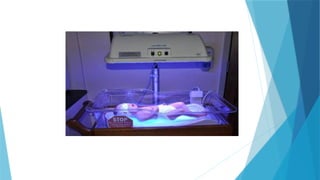 phototherapy newborn baby in obstetrics and gynaecological nursing | PPTX