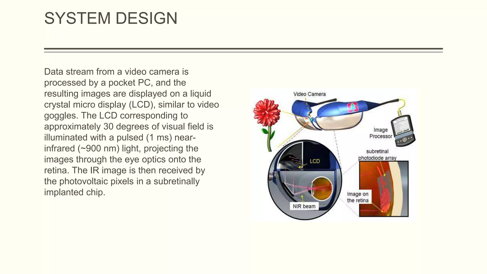 Photovoltaic retinal prosthesis for restoring sight to the blind | PPTX ...