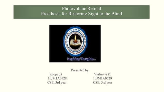 Photovoltaic retinal prosthesis for restoring sight to the blind | PPTX | Eye and Vision ...