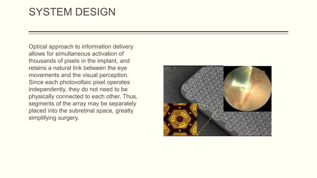 Photovoltaic retinal prosthesis for restoring sight to the blind | PPTX ...