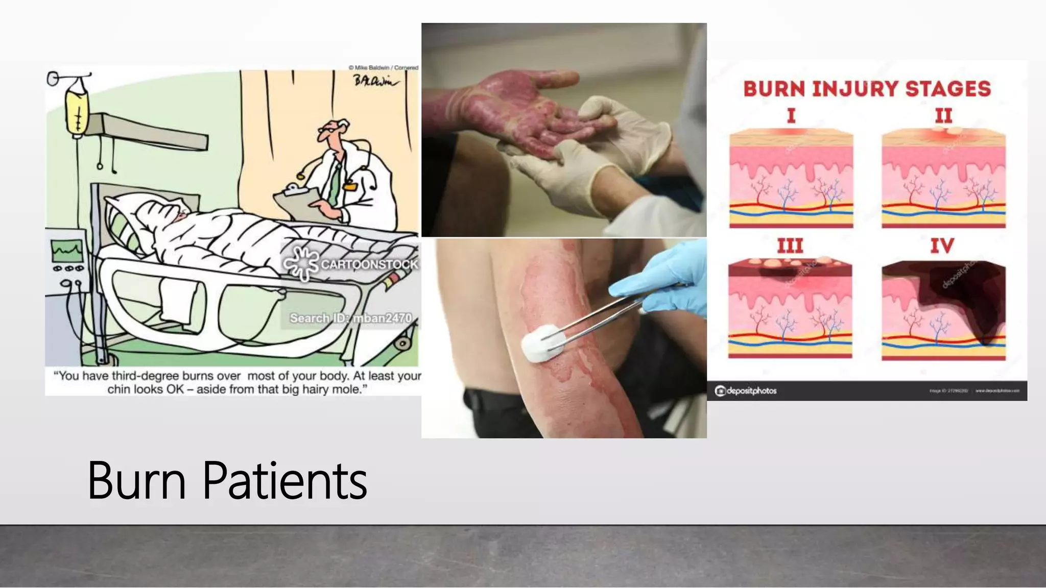 Heparin in burns By Linus Lay | PPTX