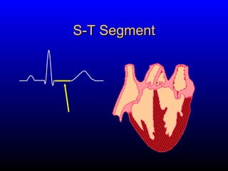 Php403 03-ekgCardiac electrophysiology | PPT