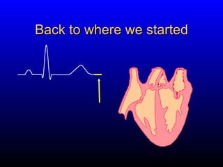 Php403 03-ekgCardiac electrophysiology | PPT