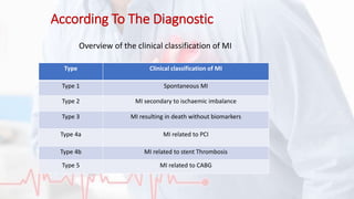 Myocardial Infarction | PPTX