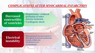 Myocardial Infarction | PPTX